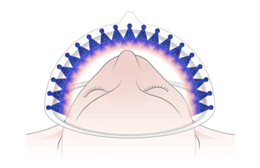 Eyeconic | Opera LED Mask